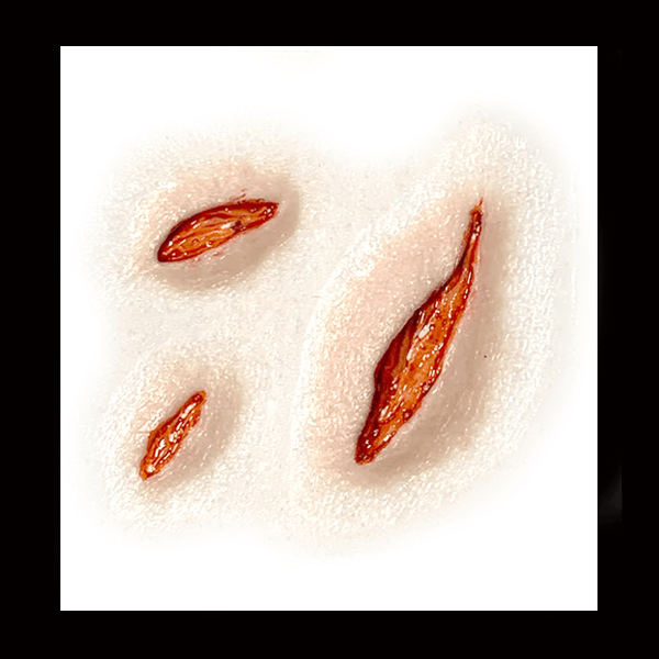 Split Skin - Realistic Cuts - Tinsley Transfers